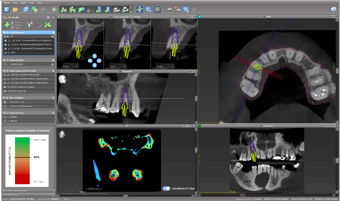 IMPLANZ - Dental Implantology Software Solutions